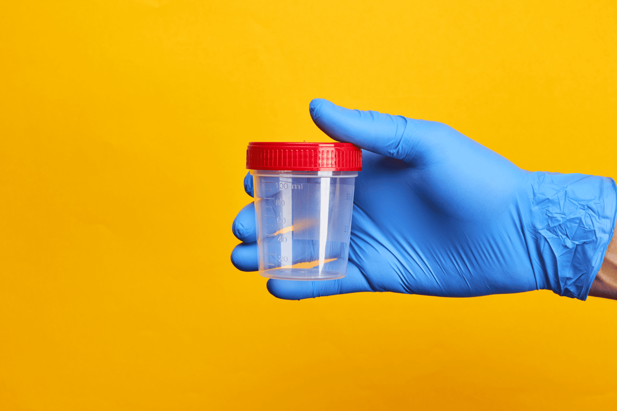 Does Delta 8 Show Up On A Drug Test Thiessen Law Firm